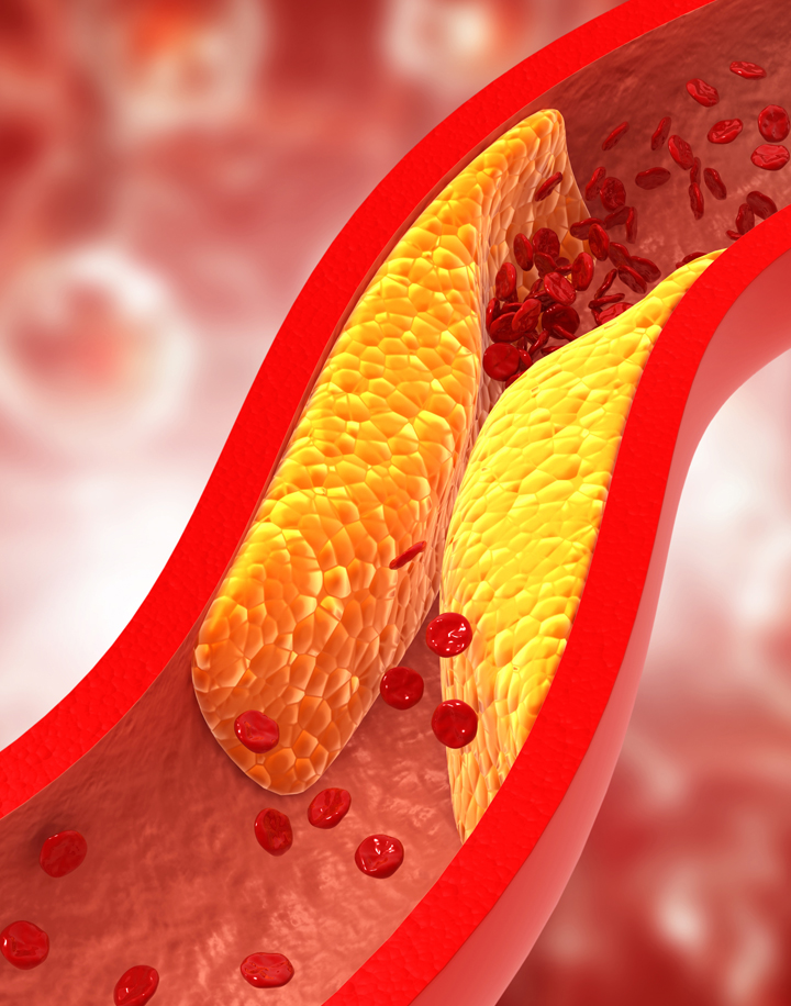 Colesterolo Alto e Alimentazione: consigli e curiosità | Céréal